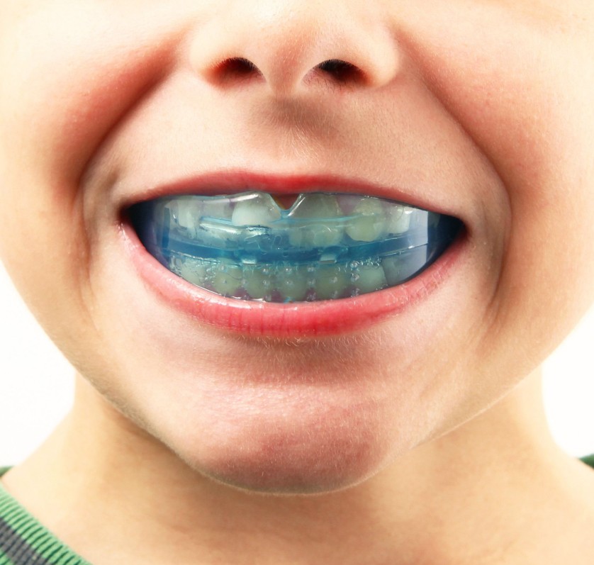 Comment Utiliser Un Protège Dents – EDKNFQ
